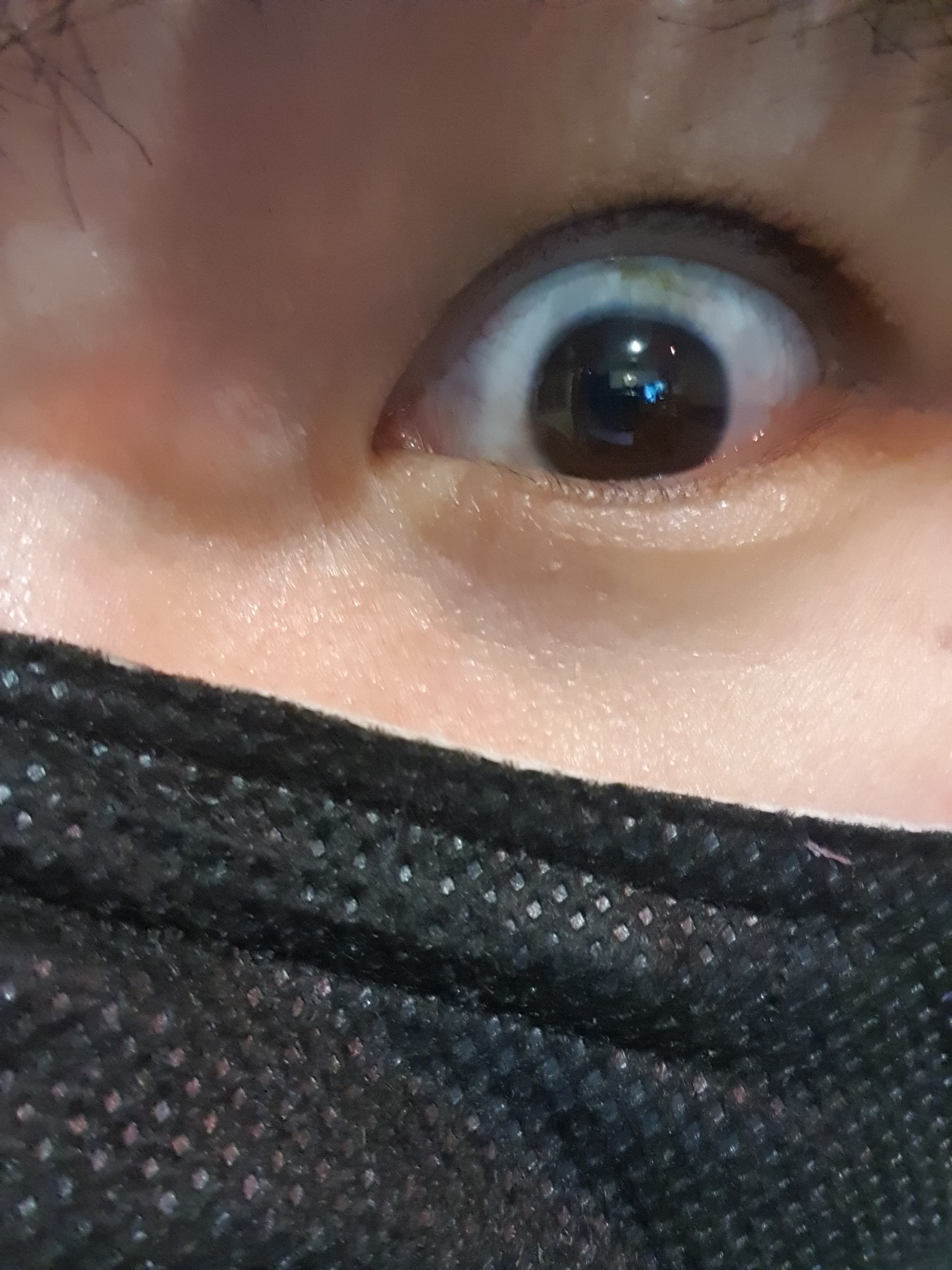 님들 나 눈작은편이야??