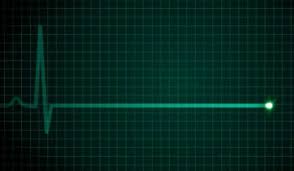 크흑.. 끝내 OTL 은 돌아가셨습니다.. :: 웃긴대학 지식OTL